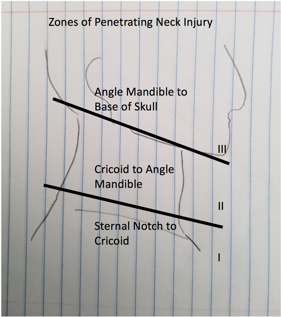 traumatic carotid injury – A Surgeon's Notes