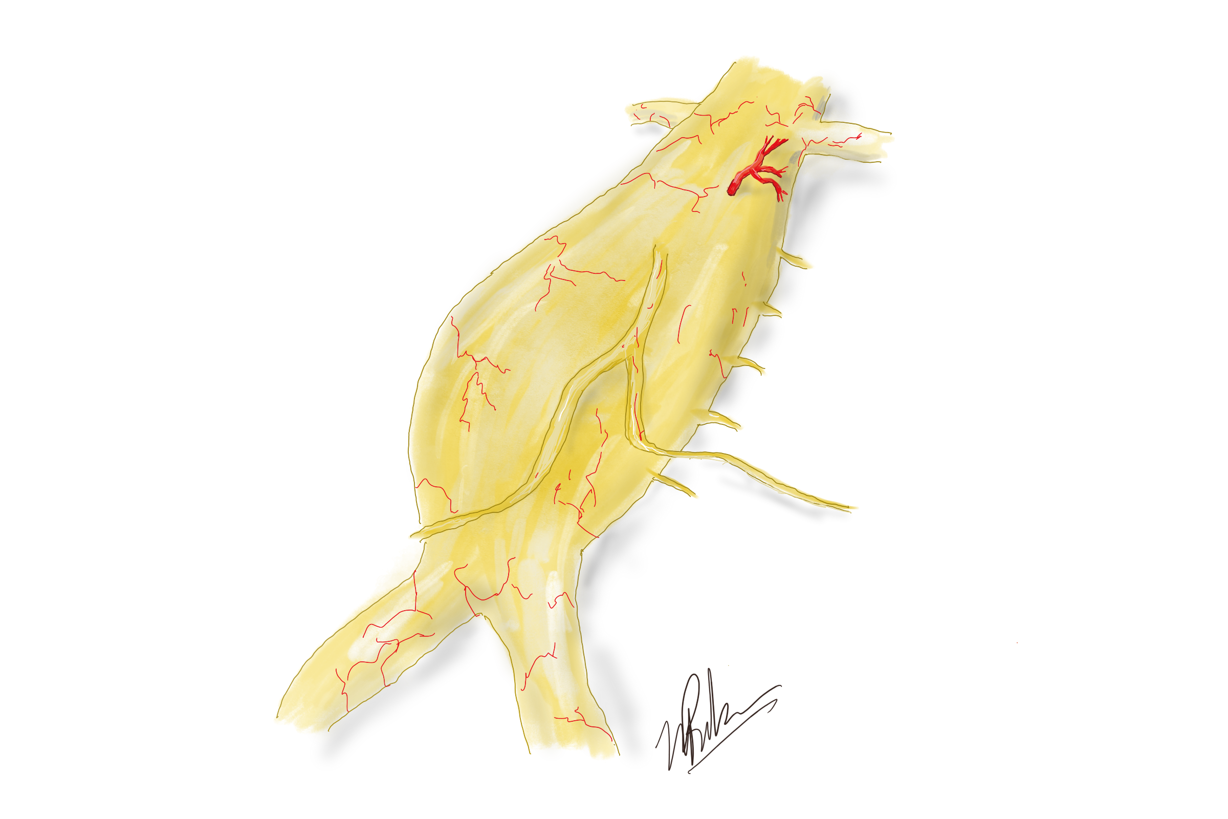 AAA – A Surgeon's Notes