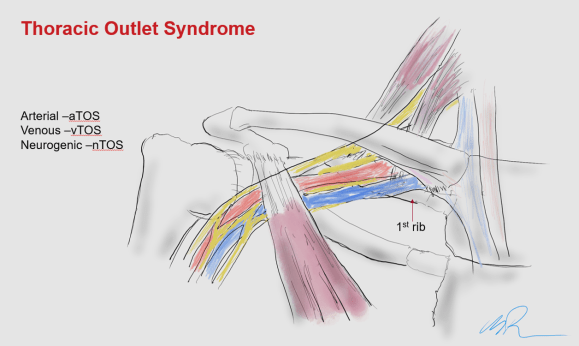 A Surgeon's Notes – to cut is to cure – a vascular surgery blog